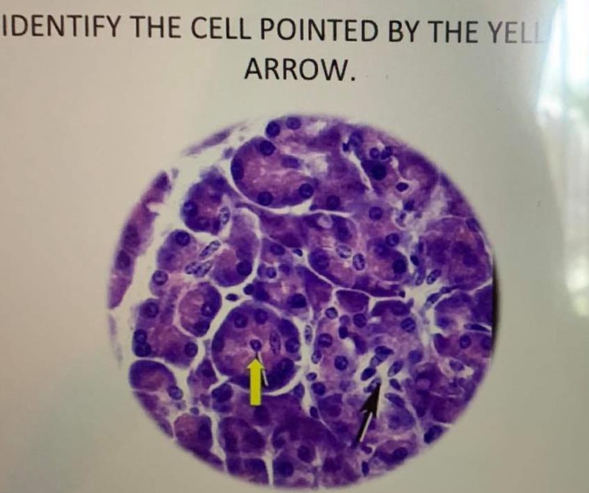 Solved IDENTIFY THE CELL POINTED BY THE YELL ARROW. | Chegg.com