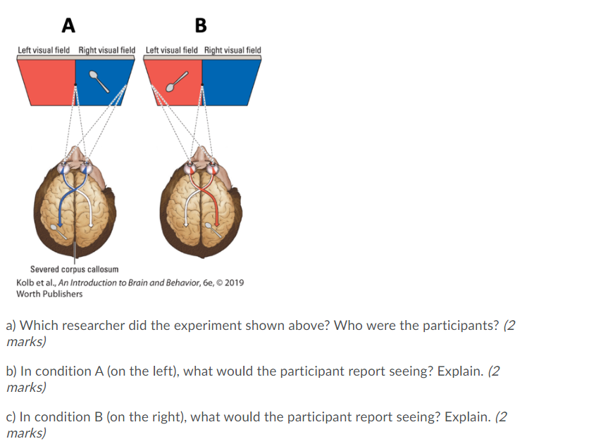 Solved A B Left visual field Right visual field Left visual | Chegg.com