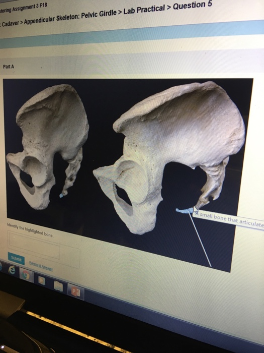 Solved tering Assignment 3 F18 Cadaver > Appendicular | Chegg.com