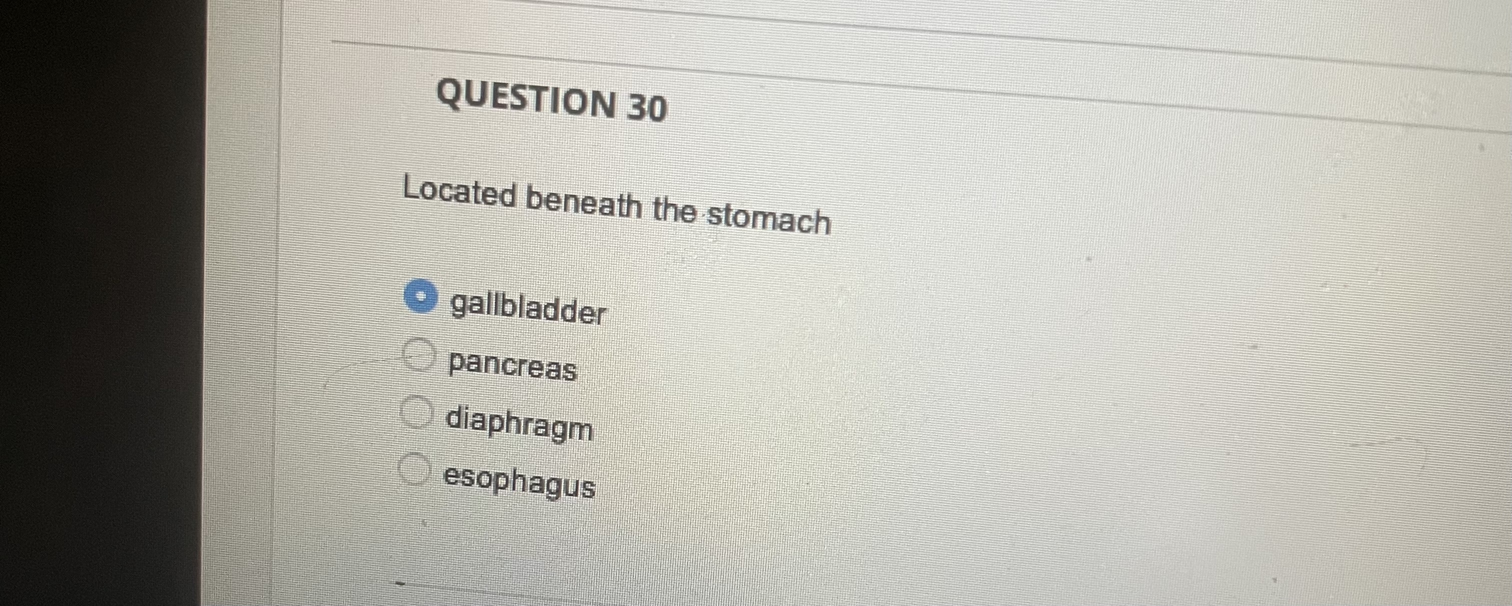 Solved QUESTION 30Located beneath the | Chegg.com