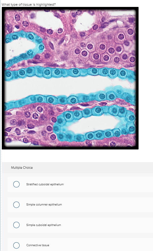 Solved What type of tissue is highlighted? Multiple Choice | Chegg.com
