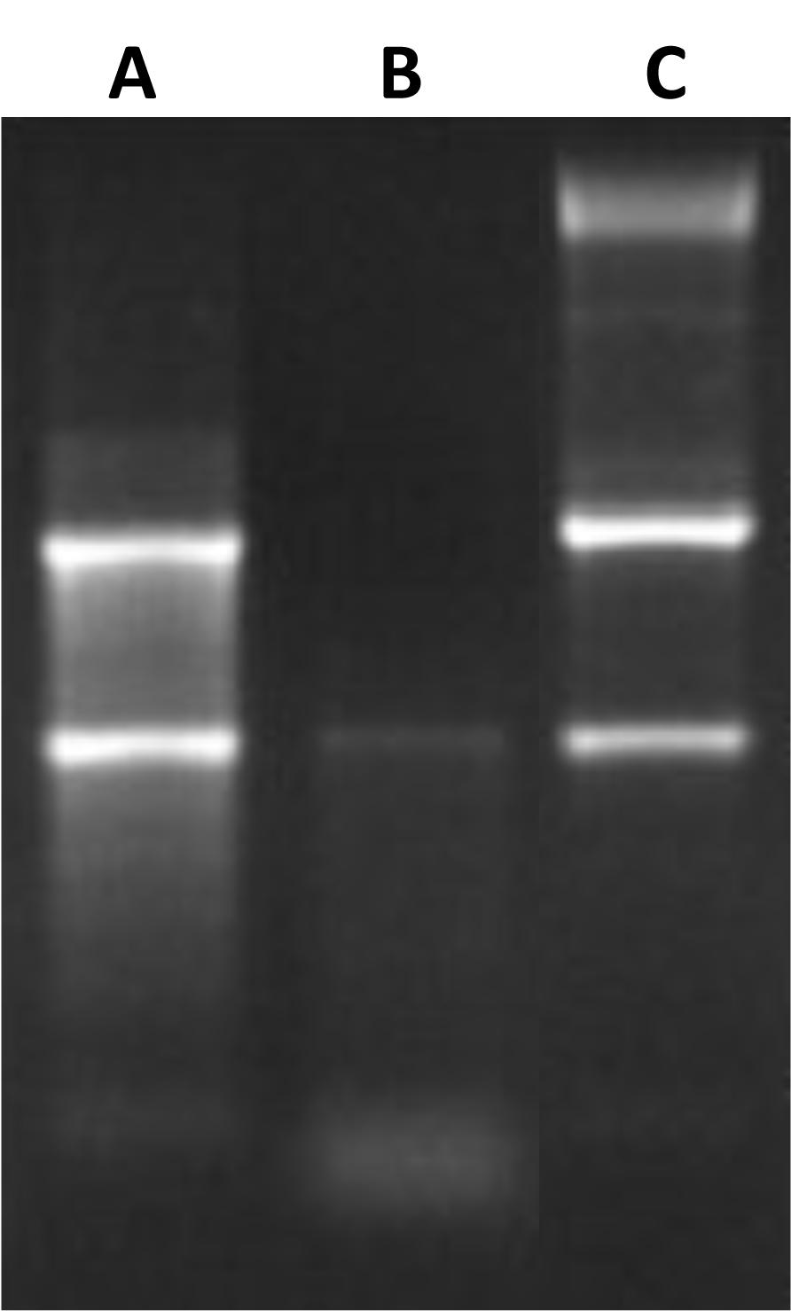 Solved A researcher isolated total RNA from 3 sources and | Chegg.com