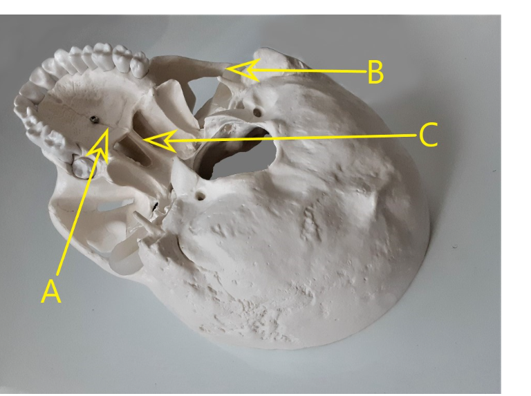 Solved 1.The projection "A" is [ Select ] ["zygomatic | Chegg.com