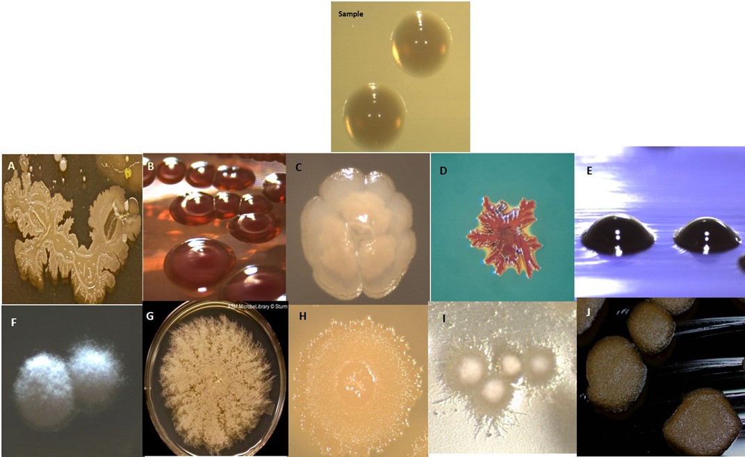 Colony Morphology Of Bacteria