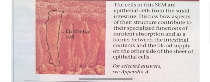 Solved The cells in this SEM are epithelial cells from the | Chegg.com