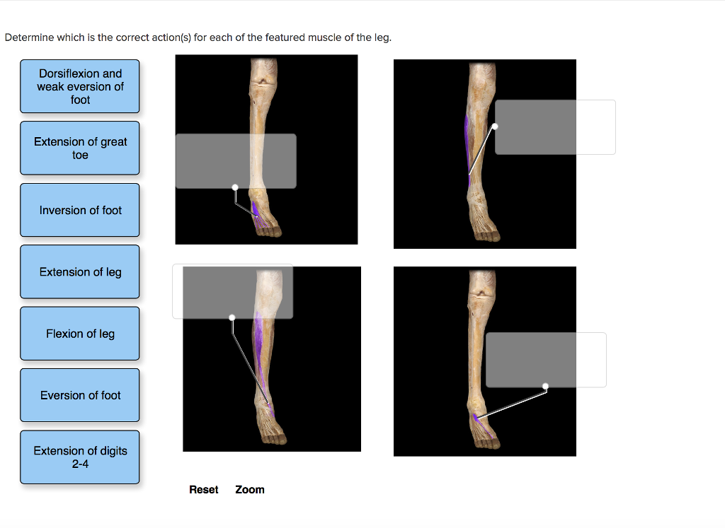 Solved Determine which is the correct action(s) for each of | Chegg.com