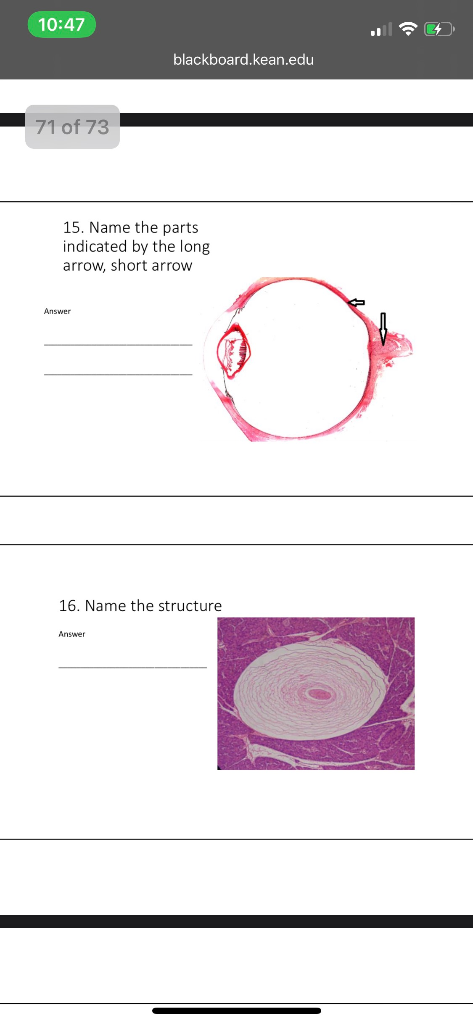 Solved 10:47 blackboard.kean.edu 71 of 73 15. Name the parts | Chegg.com