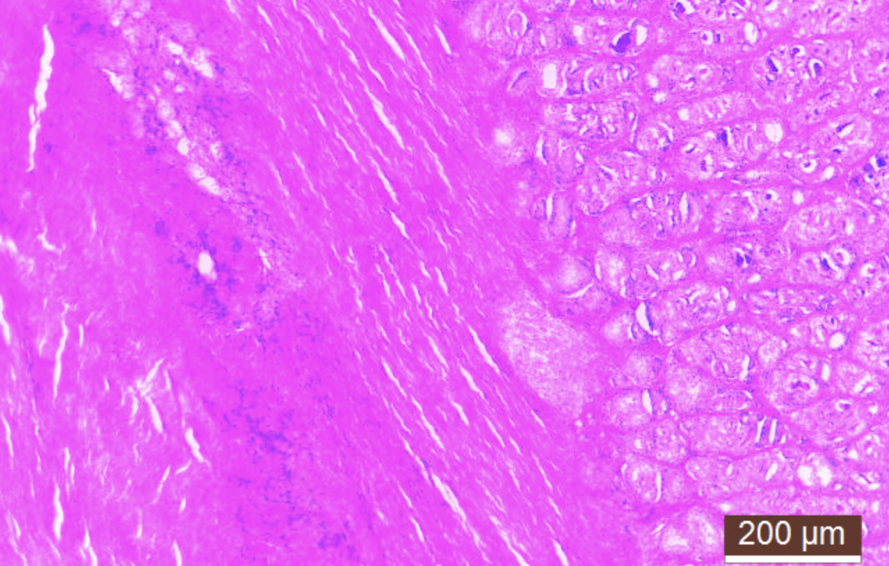 Solved This is a PAS stain of a chicken gizzard. What tissue | Chegg.com