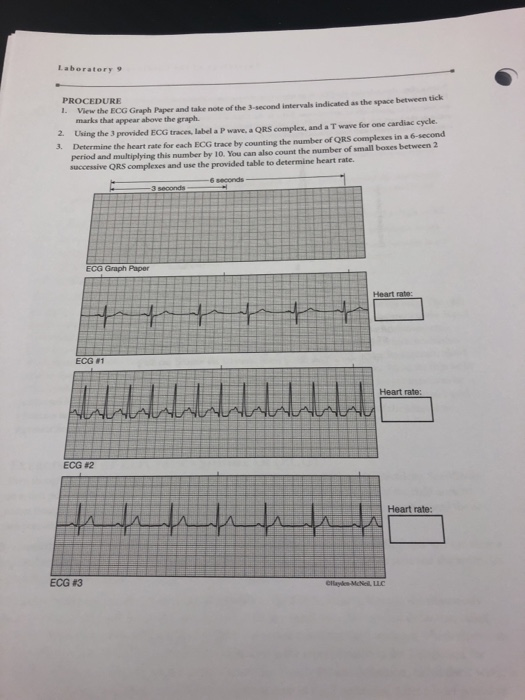 Solved Laboratory9 1. View the ECG Graph Paper and take note | Chegg.com