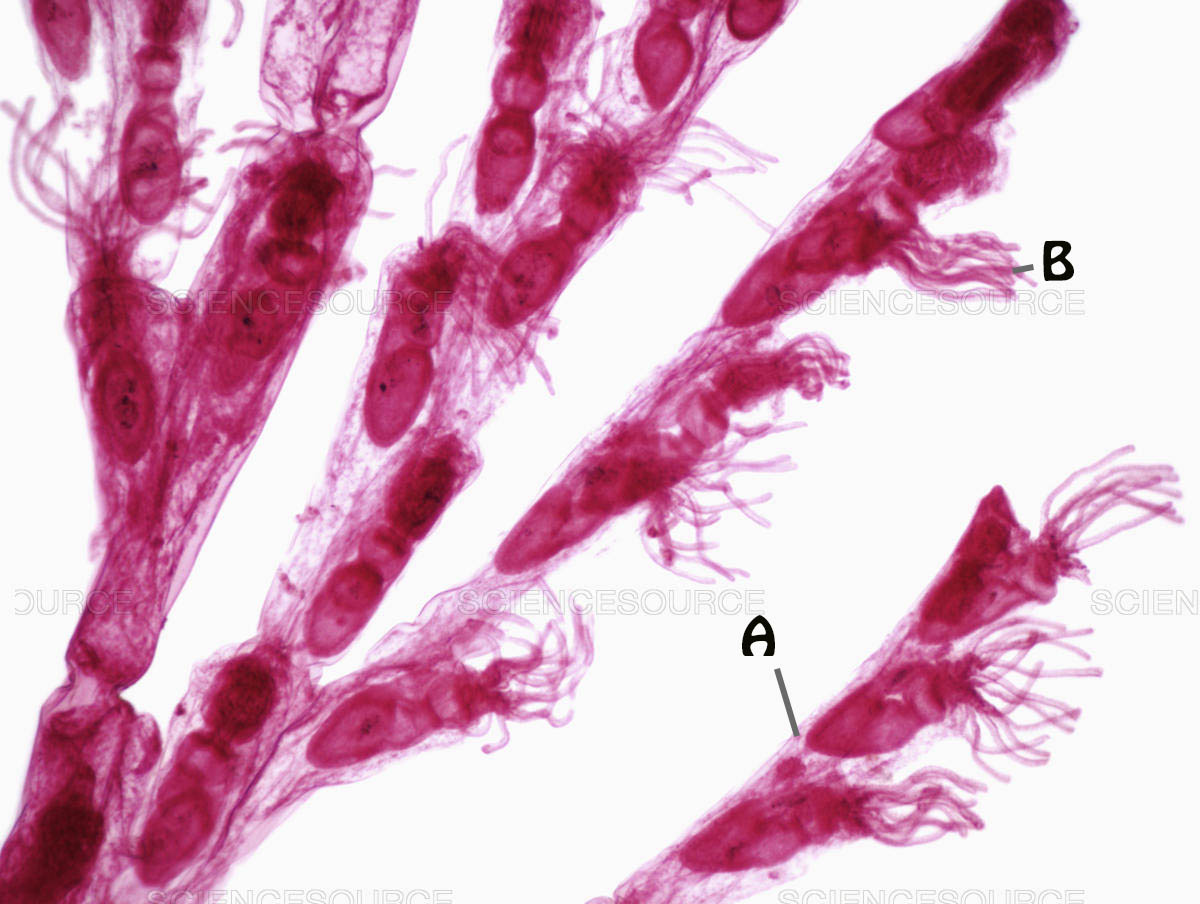 Solved What is the phylum? What is the structure at A? | Chegg.com