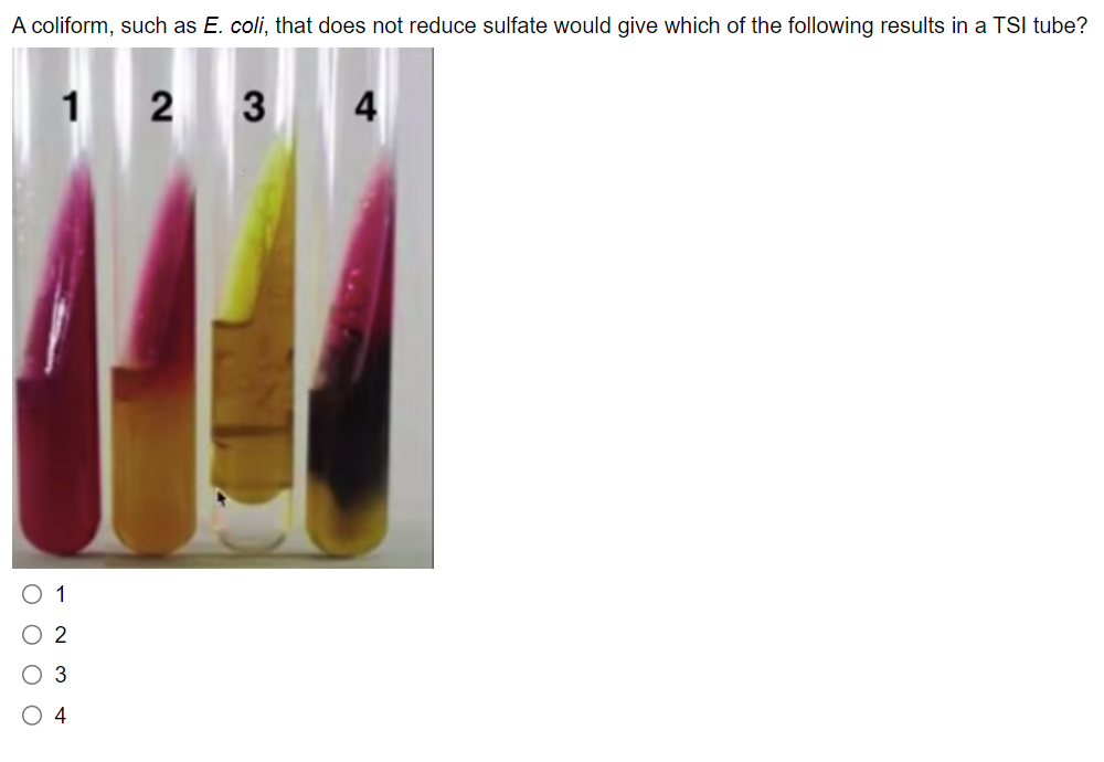 Solved An aerobe inoculated in a TSI tube would give which | Chegg.com