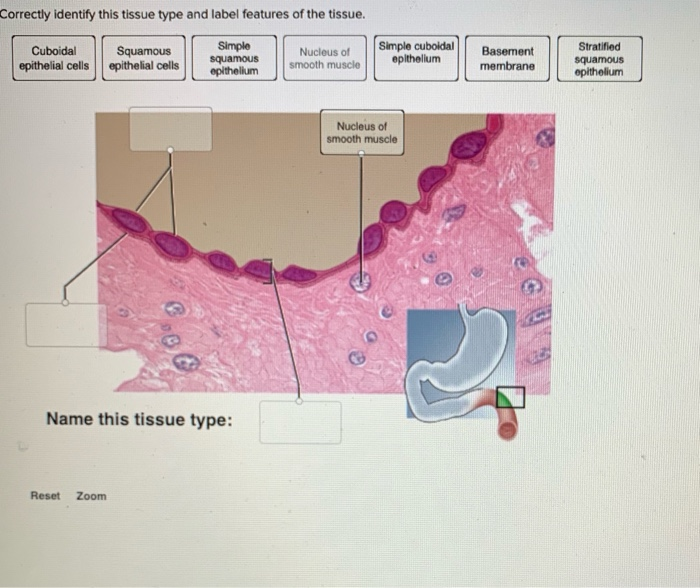 Solved: Correctly Identify This Tissue Type And Label Feat... | Chegg.com Solved: Correctly Identify This Tissue Type And Label Feat... | Chegg.com