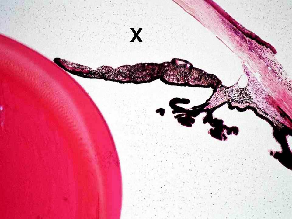 Solved Name the chamber labeled X.A. ﻿Vitreous chamberB. | Chegg.com