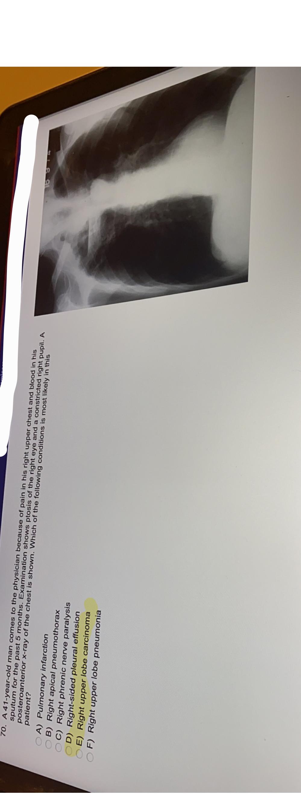 Solved 1. A 52-year-old man has an adenoma of the adrenal | Chegg.com