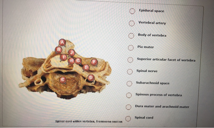 Solved Drill Level 1: Cadaver Practicals, Spinal cord, | Chegg.com