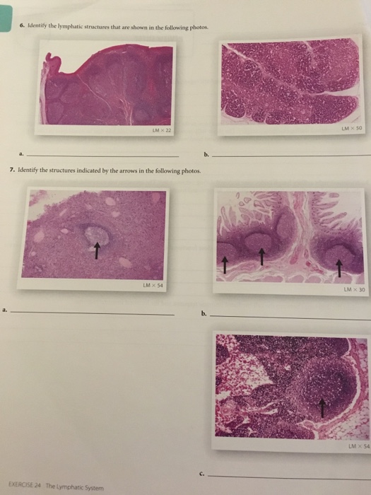 Solved 6. Identify the lymphatic structures that are shown | Chegg.com Solved 6. Identify the lymphatic structures that are shown | Chegg.com