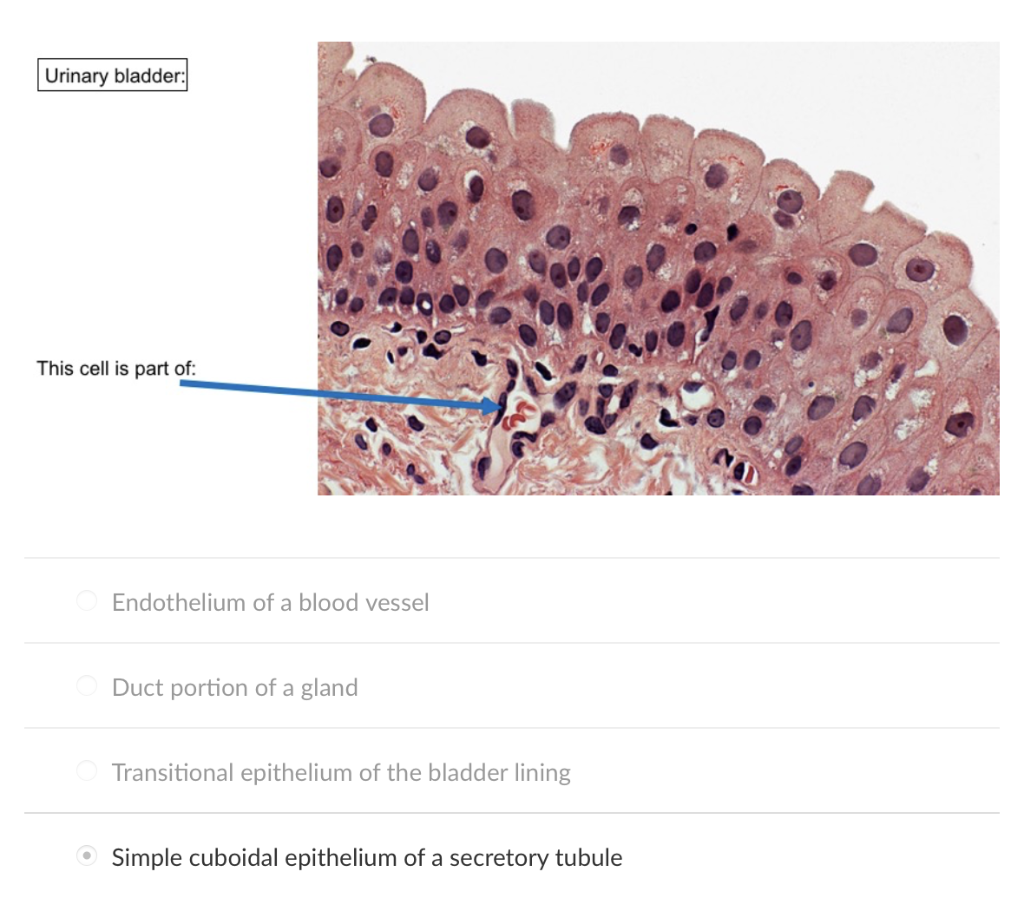 Solved Urinary bladder:) This cell is part of: Endothelium | Chegg.com