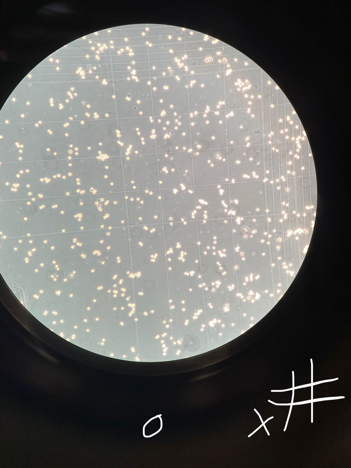 Solved Counting trypsinized cells (with 2.5% 0% (control) | Chegg.com