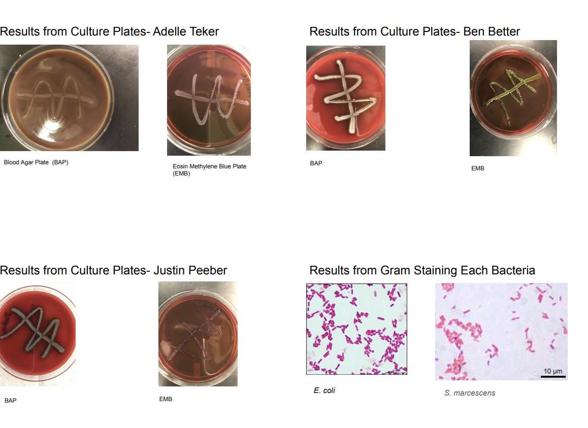 Isolation and identification of Enteric Bacteria from | Chegg.com