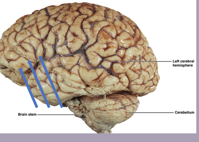 Solved Drag the name of the structure indicated by the blue | Chegg.com