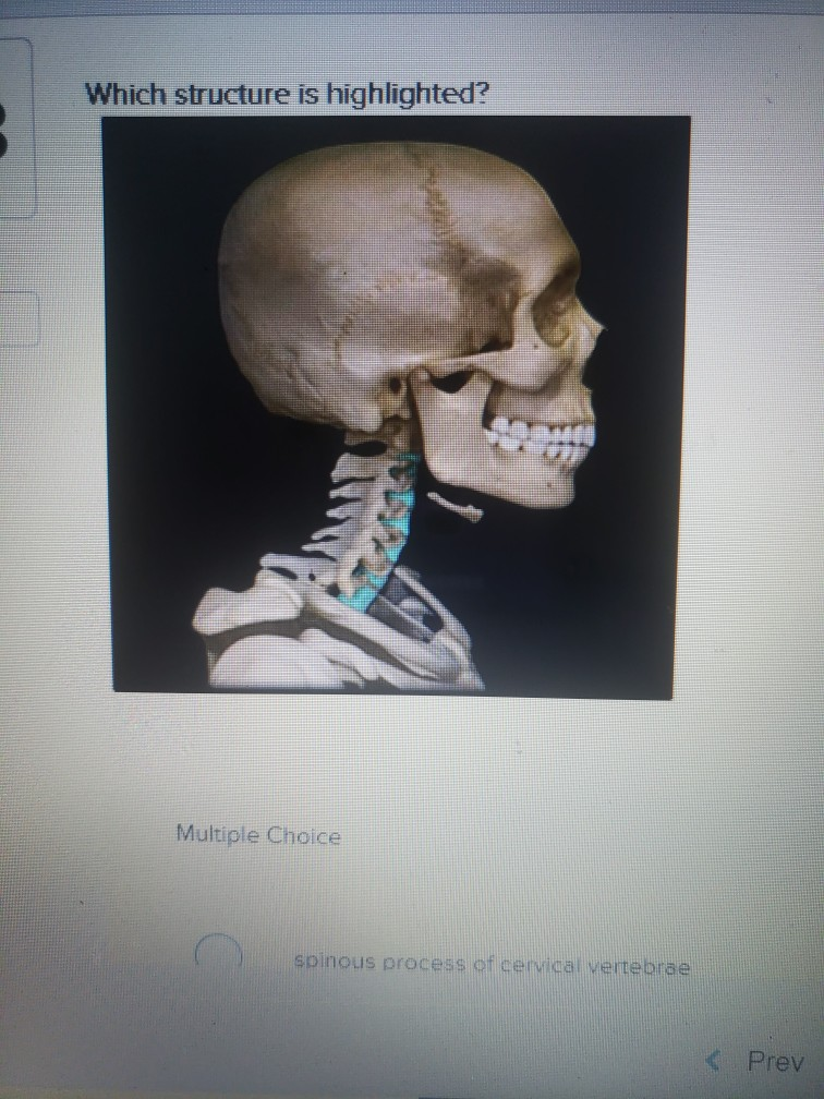 Solved Which structure is highlighted? Multiple Choice | Chegg.com
