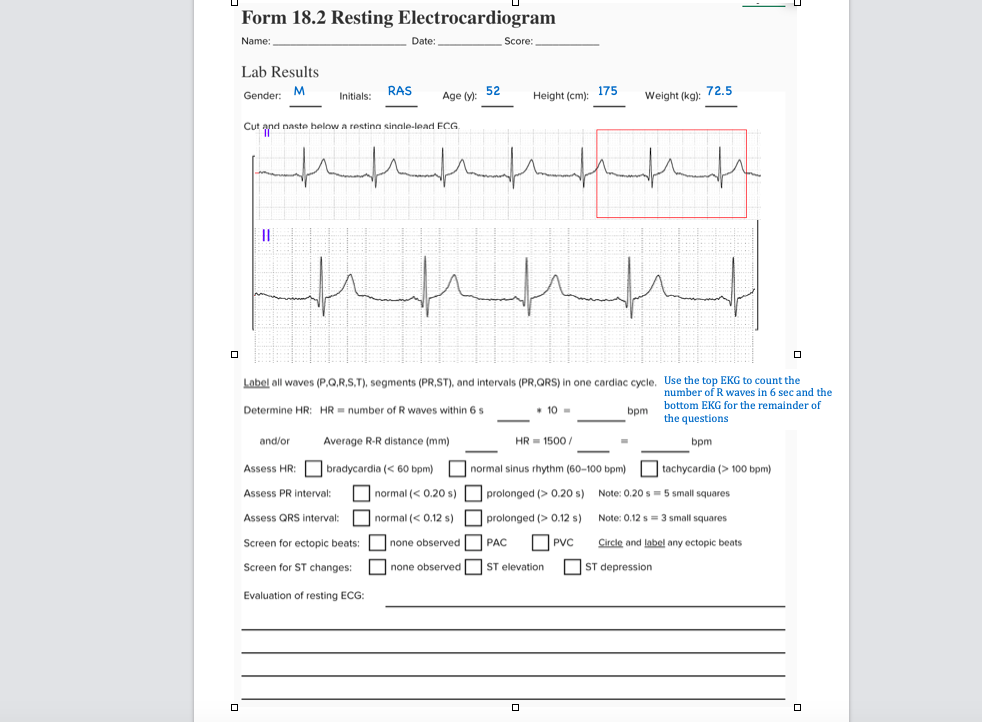 Solved Form 18.2 Resting Electrocardiogram Name: Date: | Chegg.com