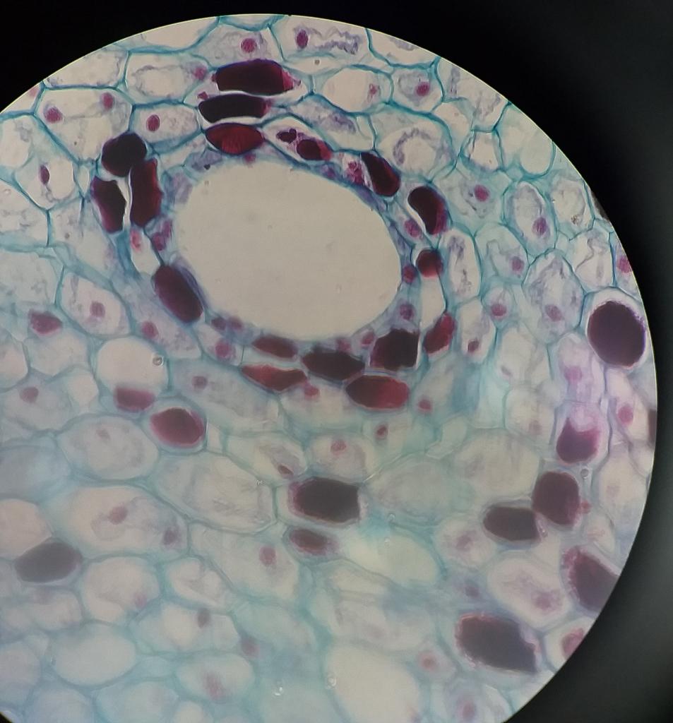 Solved Identify the parts of this gymnosperm stem under the | Chegg.com