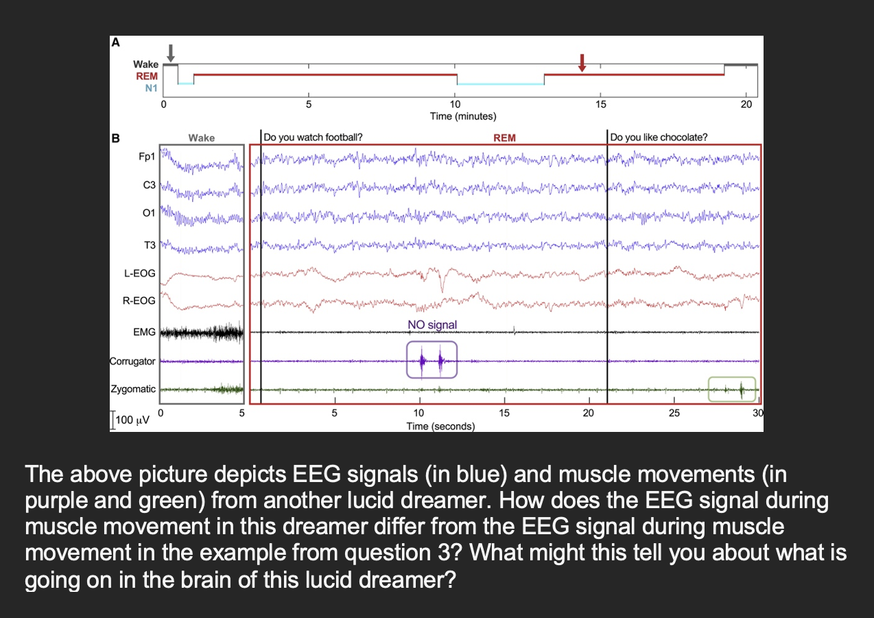 Solved The above picture depicts EEG signals (in blue) and | Chegg.com