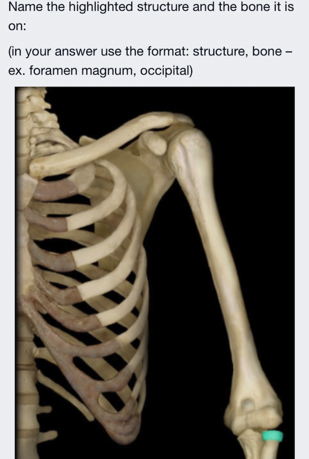 Solved Name the highlighted structure and the bone it is on: | Chegg.com