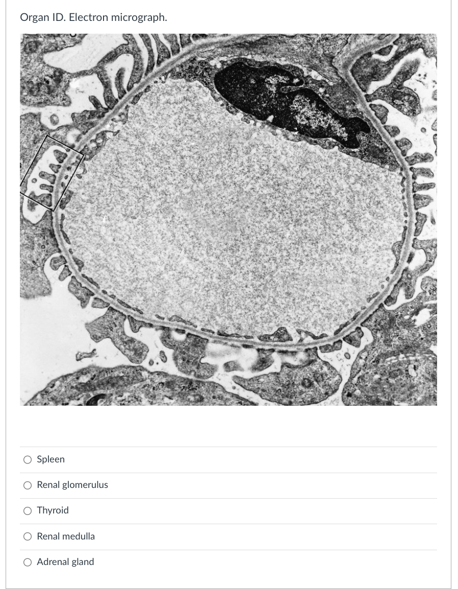 Solved Organ ID. Electron micrograph. Spleen Renal | Chegg.com
