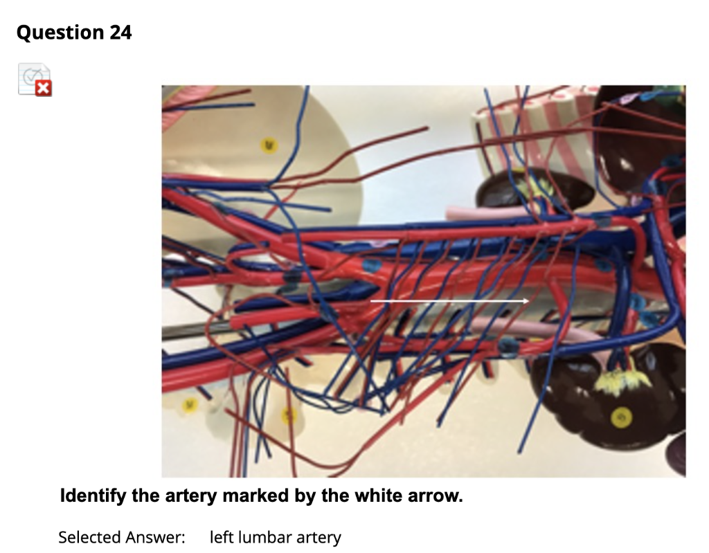 Solved Identify the vein marked by the white arrow. Selected | Chegg.com