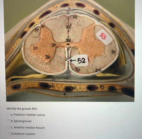 Solved 33 53 34 32 37 36. 52 30 Identify the groove #52. a. | Chegg.com