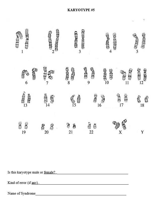 Solved Is this karyotype male or female? Kind of error (if | Chegg.com