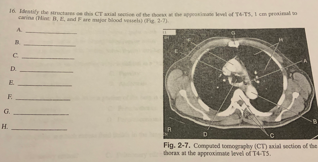 Solved 16. Identify the structures on this CT axial section | Chegg.com