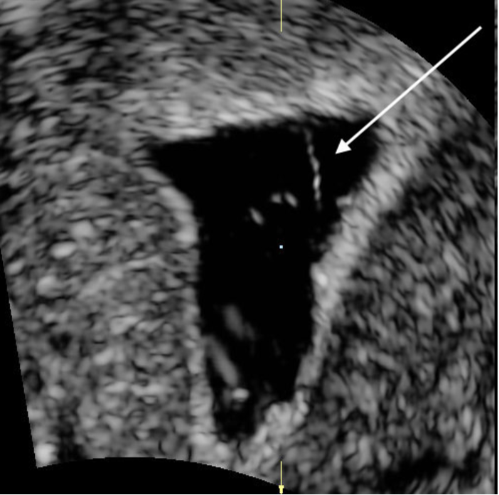 Solved Describe The Sonographic Appearance And Identify The