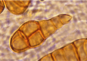 Solved What term is used to describe the septation | Chegg.com