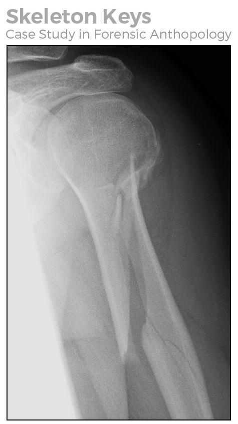 Forensic Anthropology Case Study Background | Chegg.com