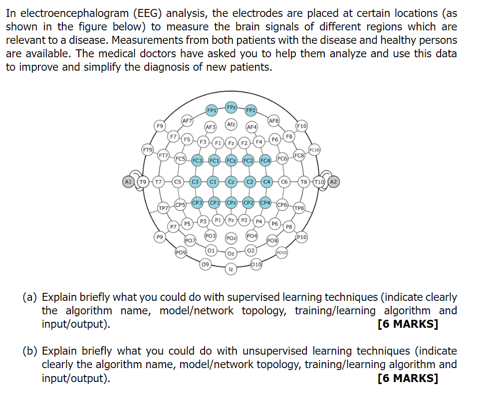 Solved In electroencephalogram (EEG) analysis, the | Chegg.com