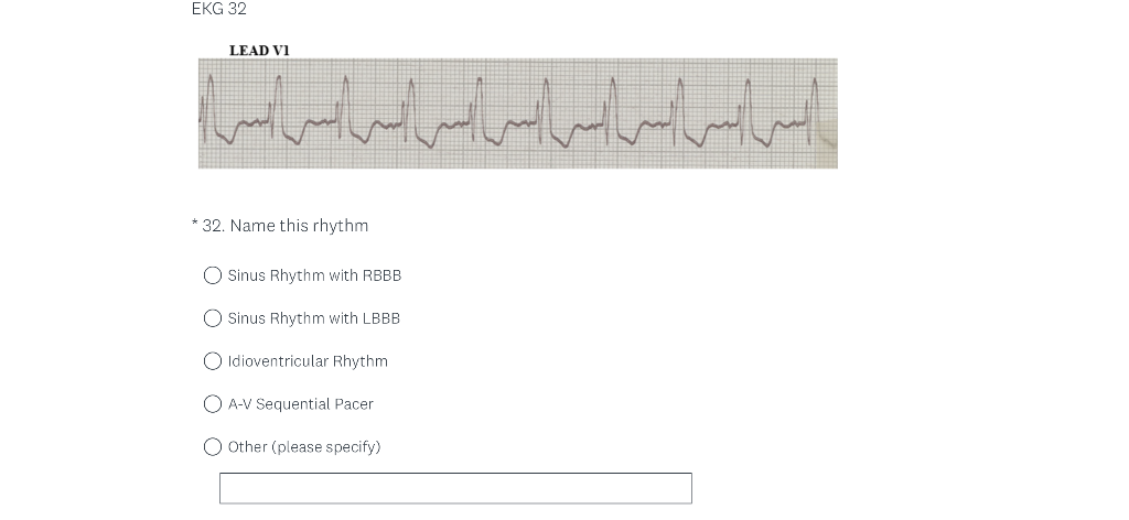 Solved Use the EKG strips to answer the questions below each | Chegg.com