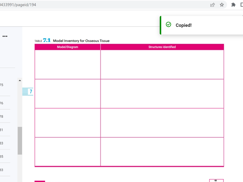 Solved Model Inventory for Compact and Spongy Bone Identify | Chegg.com