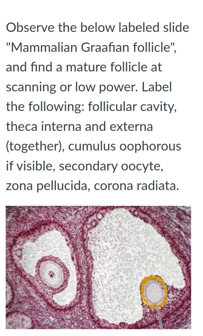 Solved Observe the below labeled slide "Mammalian Graafian | Chegg.com