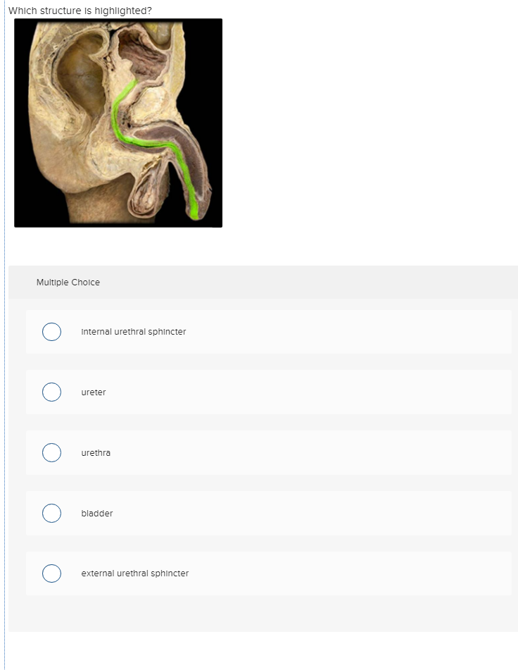 Solved Which structure is highlighted? Multiple Choice Ο | Chegg.com