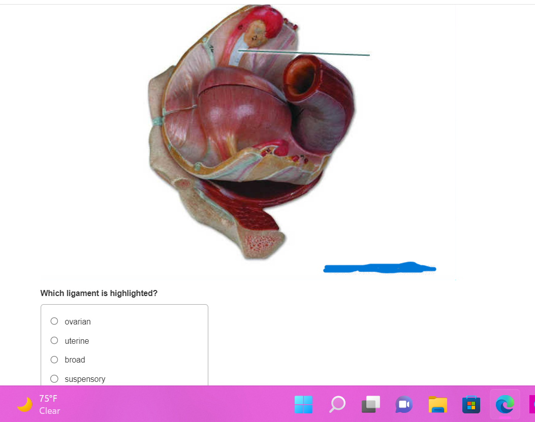 Solved Which ligament is highlighted? ovarian uterine broad | Chegg.com