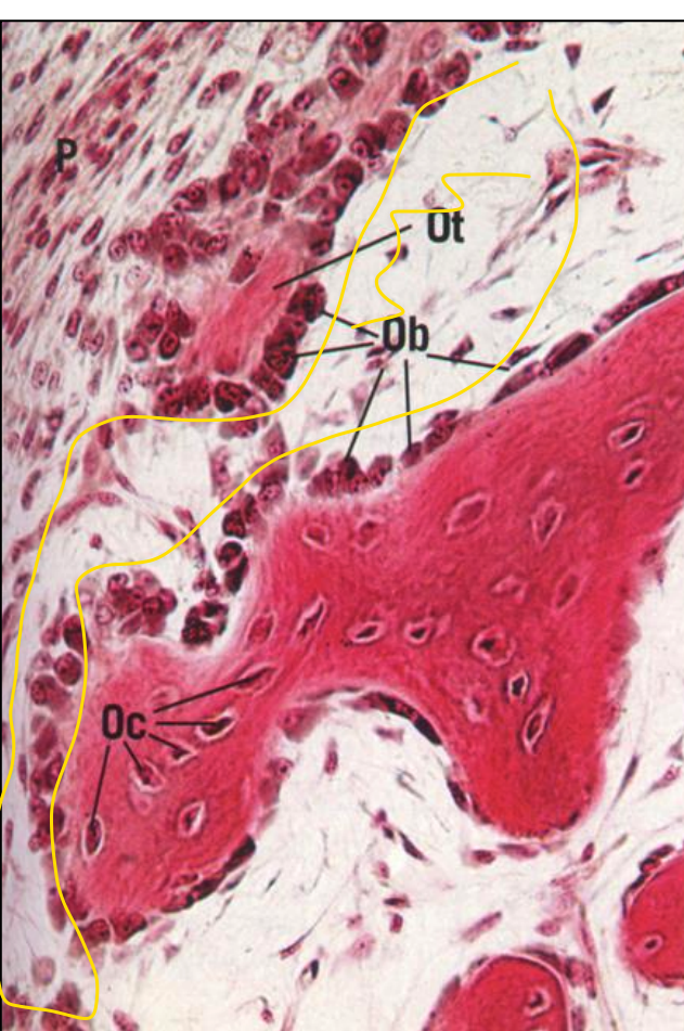 Solved Histology question about bone. Please help me | Chegg.com