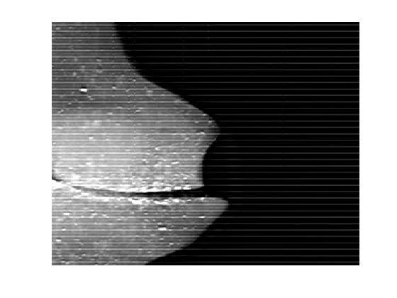 Solved -load knee_phantom into Matlab. The image, which is | Chegg.com