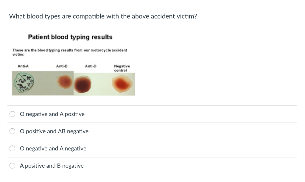 Solved What blood types are compatible with the above | Chegg.com