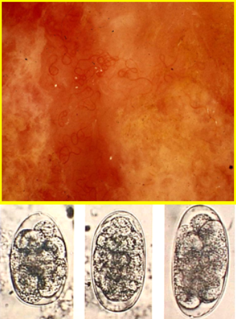 Hyostrongylus Rubidus