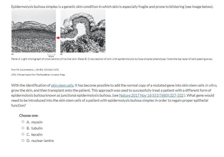 Epidermolysis bullosa simplex is a genetic skin | Chegg.com