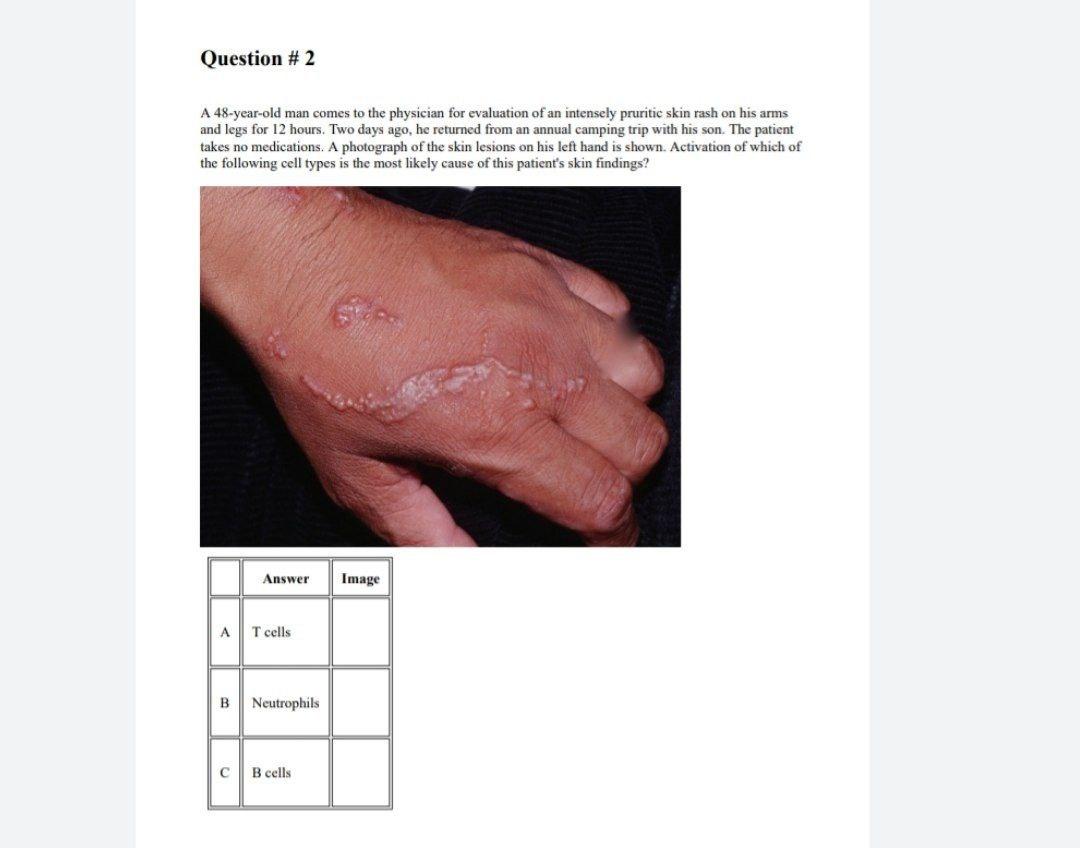 Solved Question # 2 A 48-year-old man comes to the physician | Chegg.com