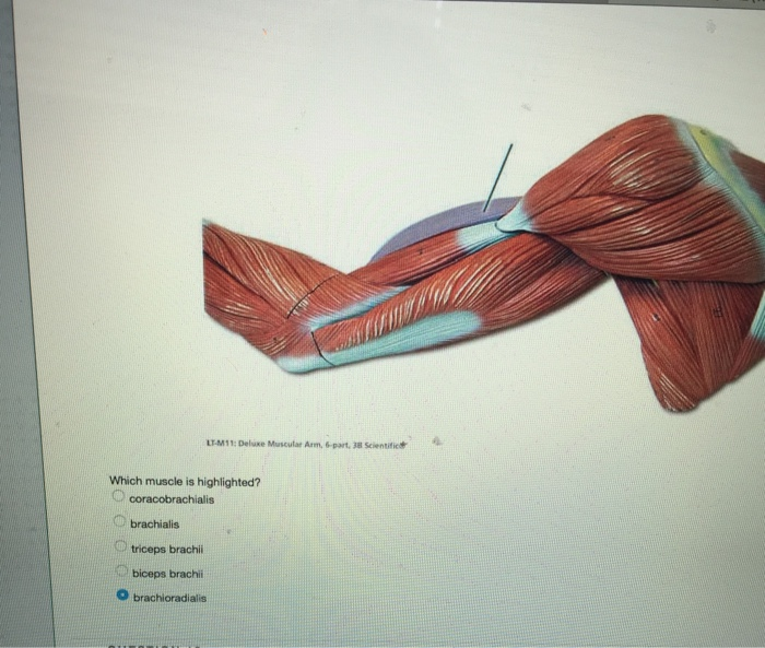 Solved LT-M11: Deluxe Muscular Arm, 6part, 38 Scientic Which | Chegg.com